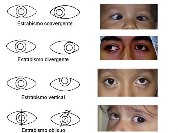 Panamericano de Ojos » Para pacientes